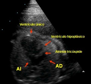 Diagnostico Fetal de las CC. Cuatro cámaras